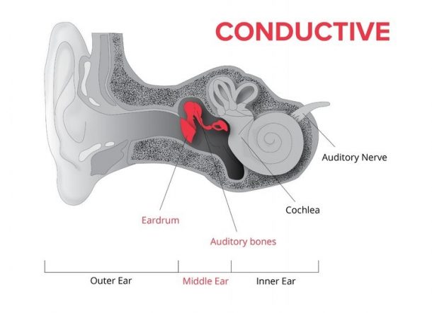 Hearing Loss Information & Resources | Lemme Audiology
